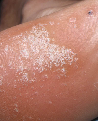 Vorter - Felleskatalogen